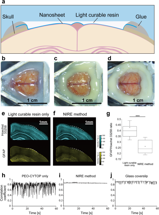 Large-scale cranial window for in vivo mouse brain imaging utilizing ...
