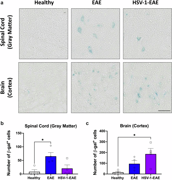 Asymptomatic herpes simplex virus brain infection elicits cellular ...