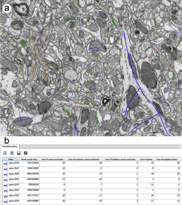 Tracing nerve fibers with volume electron microscopy to quantitatively ...