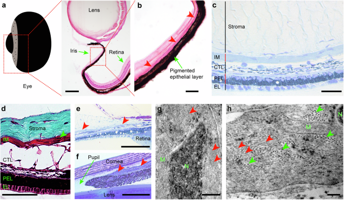 Direct retino-iridal projections and intrinsic iris contraction mediate ...