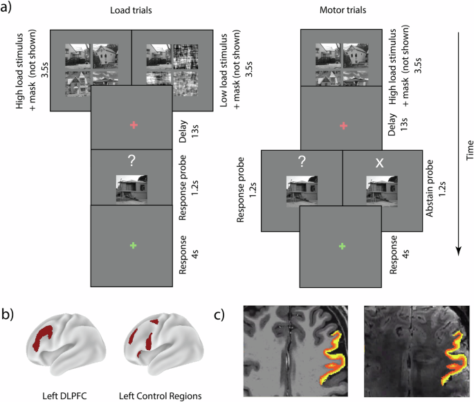 Dynamic layer-specific processing in the prefrontal cortex during working memory ...