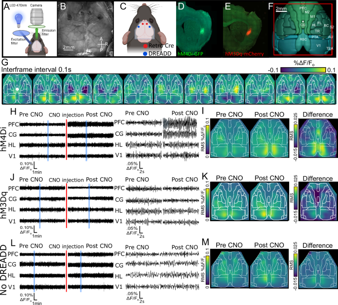 Claustrum modulation drives altered prefrontal cortex dynamics and ...