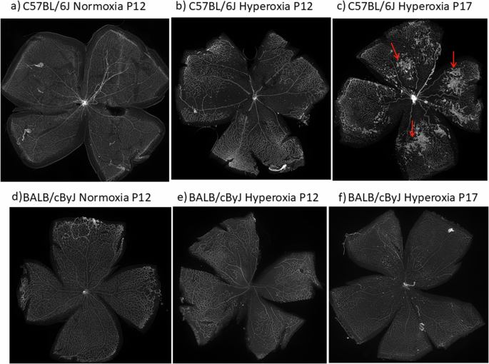 Systemic regulation of retinal medium-chain fatty acid oxidation ...