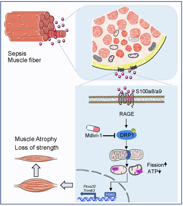 Elevated levels of S100A8 and S100A9 exacerbate muscle mitochondrial ...