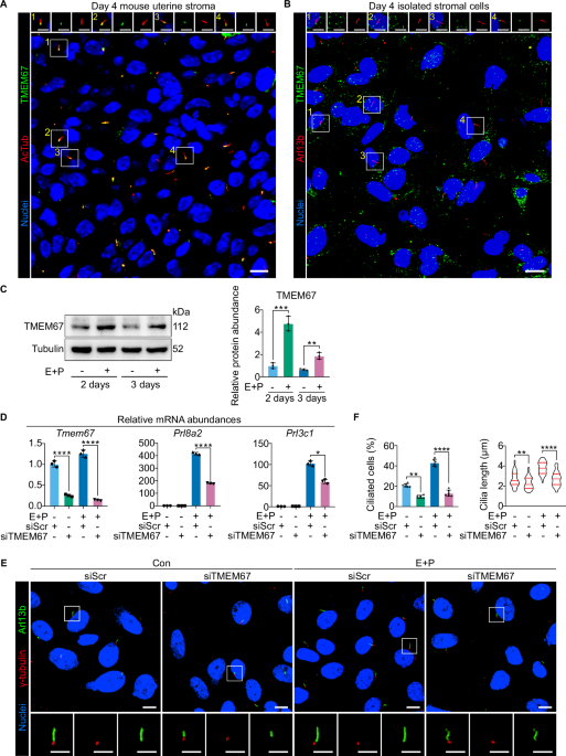 Primary cilia prevent activation of the cGAS-STING pathway during mouse ...