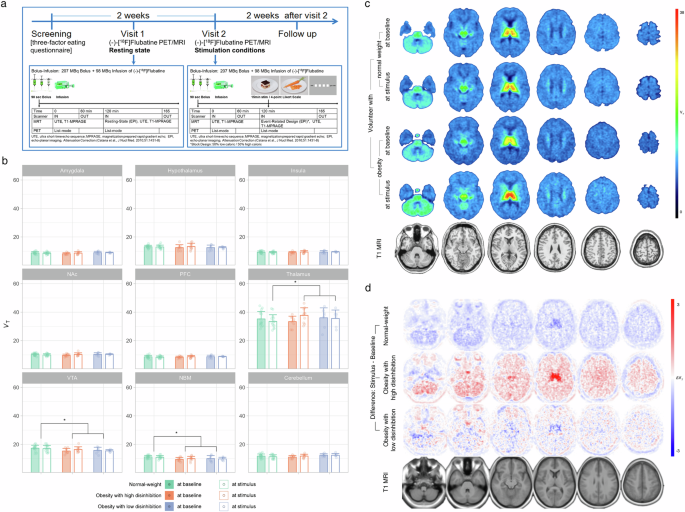 Cholinergic network modulation in disinhibited eating behavior ...