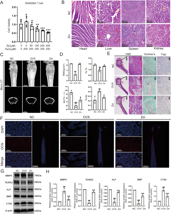 Zingerone treats postmenopausal osteoporosis via increased ferroptosis ...