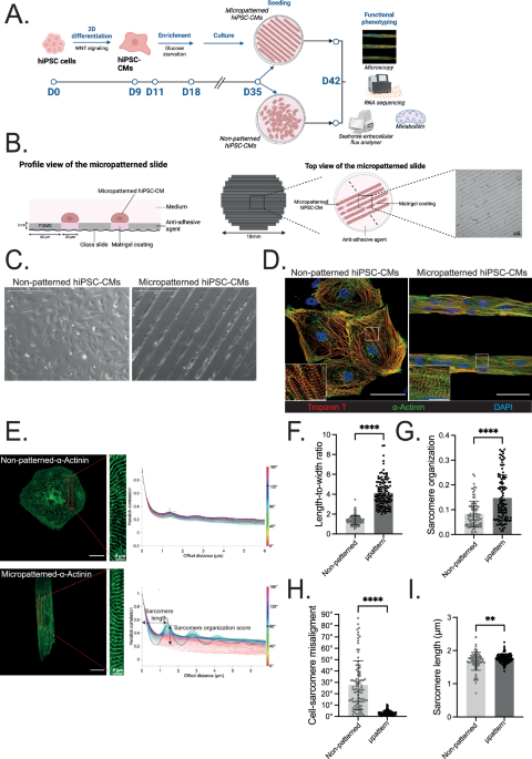 Myocardial disarray drives metabolic inefficiency in human ...