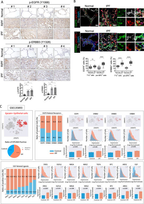 N-phenylquinazolin-4-amine-based EGFR TKIs suppress pulmonary fibrosis ...