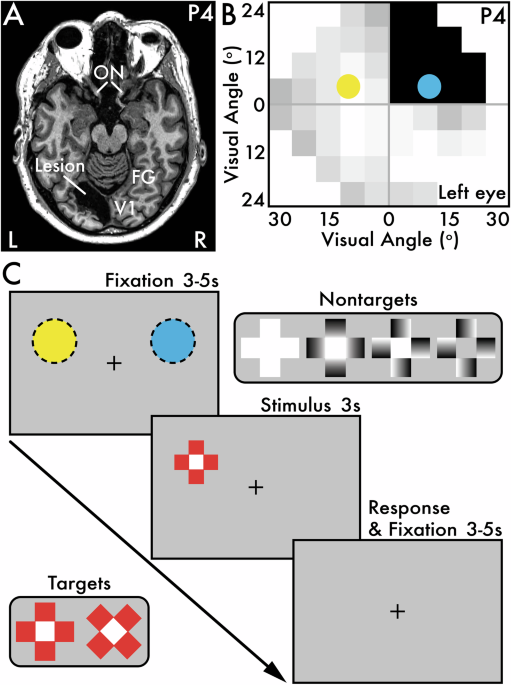 Eye metrics often reflect visual conscious awareness, conscious content ...