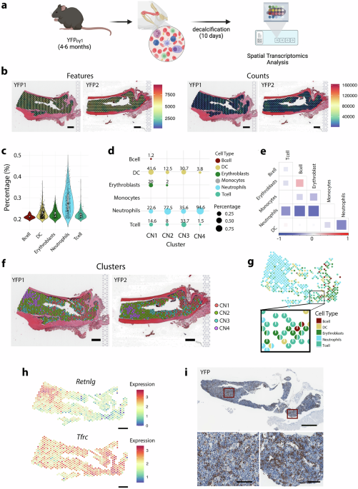 Characterization of the bone marrow architecture of multiple myeloma ...