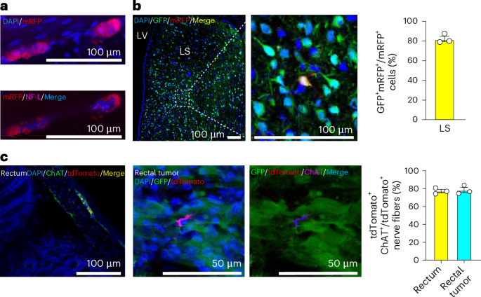 Hijacked brain–gut polysynaptic pathway promotes colorectal cancer ...