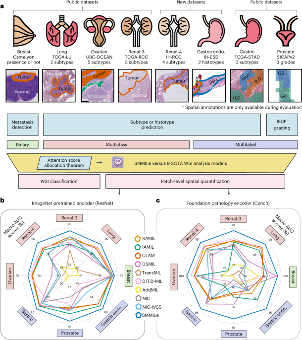 SMMILe enables accurate spatial quantification in digital pathology ...