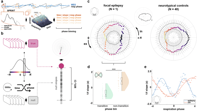 Respiratory modulations of cortical excitability and interictal spike timing in focal epilepsy ...