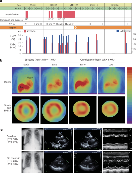 Long-term survival and durable recovery of heart failure in patients ...