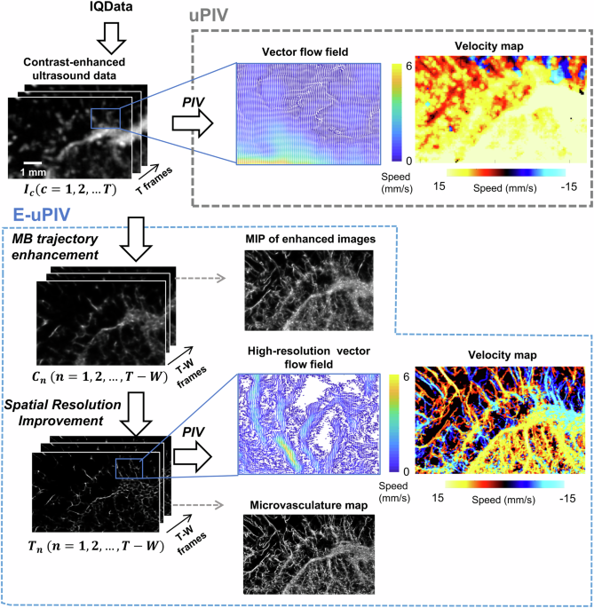Enhanced ultrasound particle image velocimetry (E-uPIV) enables fast ...