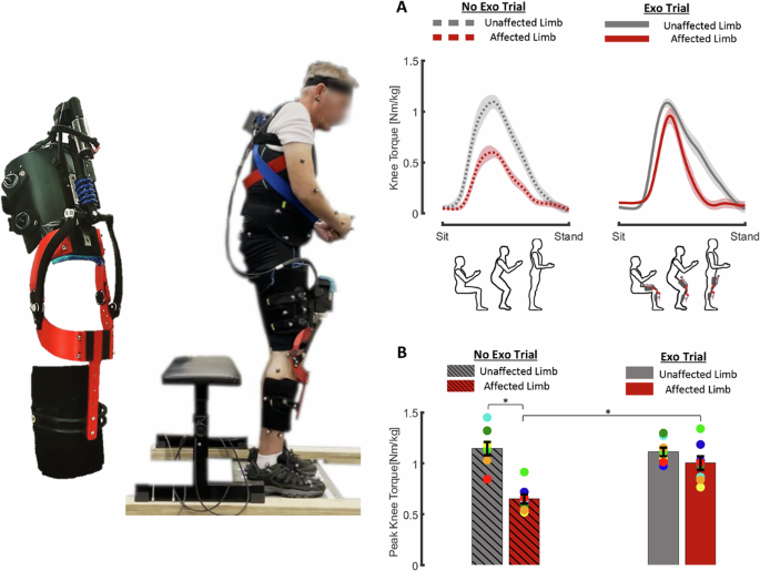 Powered knee exoskeleton improves sit-to-stand transitions in stroke ...