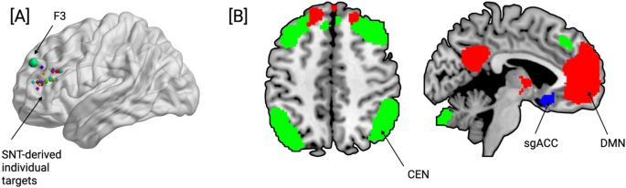Increased anti-correlation between the left dorsolateral prefrontal ...