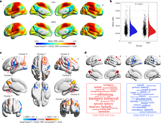 Dysfunction in sensorimotor and default mode networks in major ...