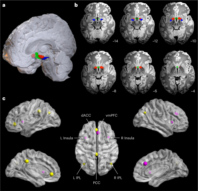 Altered basal forebrain regulation of intrinsic brain networks in ...