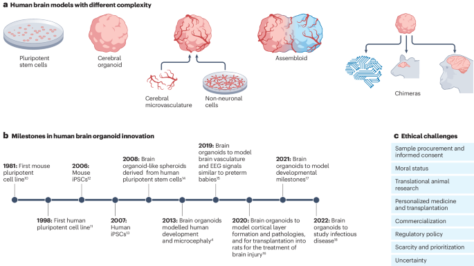 The ethical landscape of human brain organoids and a mindful innovation ...