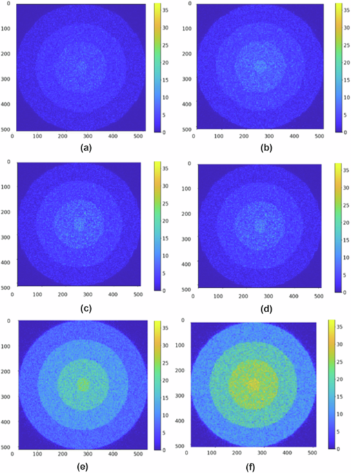 AgriSPEC: A smartphone-based, compact biospeckle imager for assessing ...