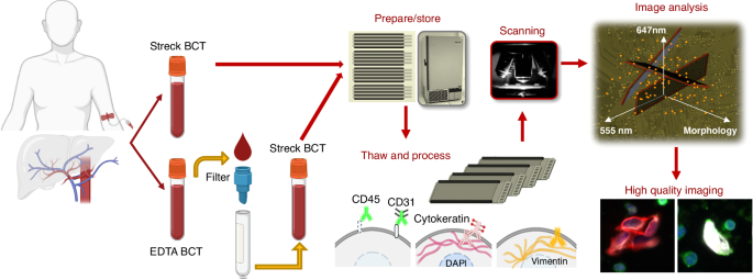 Determining the efficacy of ExThera Seraph100 blood filtration in ...