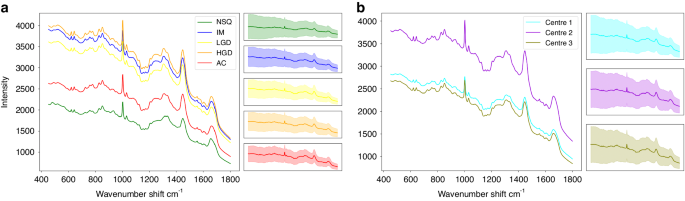 System transferability of Raman-based oesophageal tissue classification ...