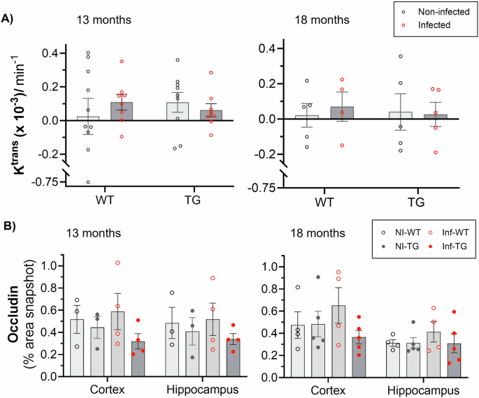 MRI detects blood-brain barrier alterations in a rat model of Alzheimer ...