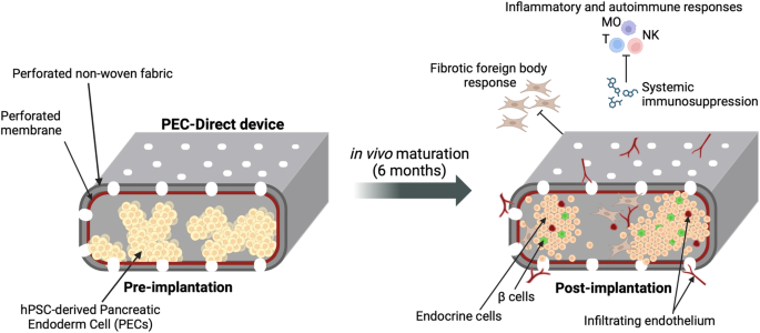 Finishing the odyssey to a stem cell cure for type 1 diabetes | npj ...