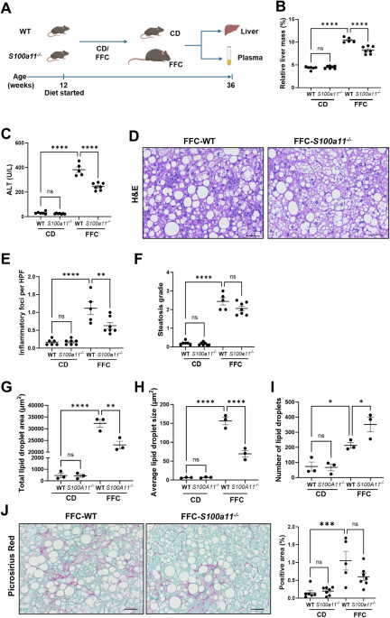 Silencing of S100A11 attenuates murine metabolic dysfunction-associated ...