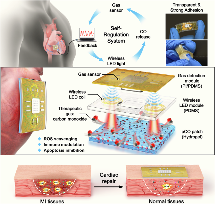 Photoactivable CO-releasing hydrogel based cardiac patch with a self ...