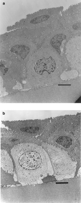 Optisol vs Dexsol as storage media for preservation of human corneal ...