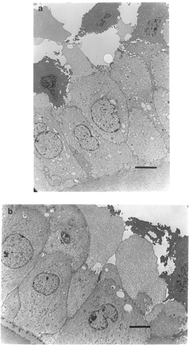 Optisol vs Dexsol as storage media for preservation of human corneal ...