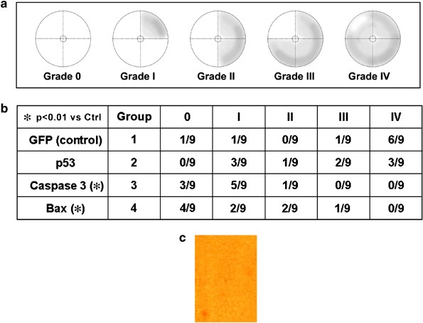 Prevention of posterior capsule opacification by the induction of ...