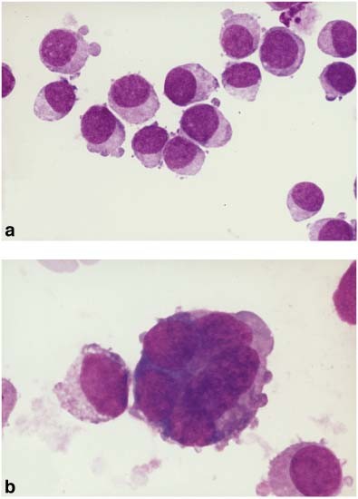 Establishment and characterization of a new human megakaryoblastic cell ...
