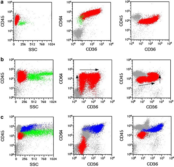 Immunophenotypic identification of acute myeloid leukemia with ...