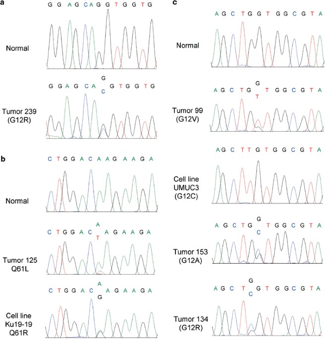 FGFR3 and Ras gene mutations are mutually exclusive genetic events in ...