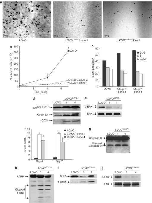 CDX2 has tumorigenic potential in the human colon cancer cell lines ...