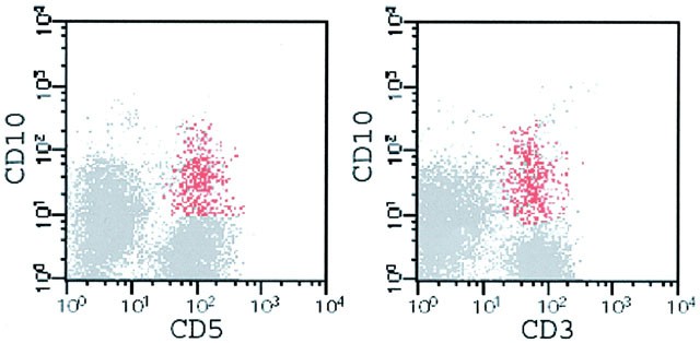 Benign CD10-Positive T Cells in Reactive Lymphoid Proliferations and B ...