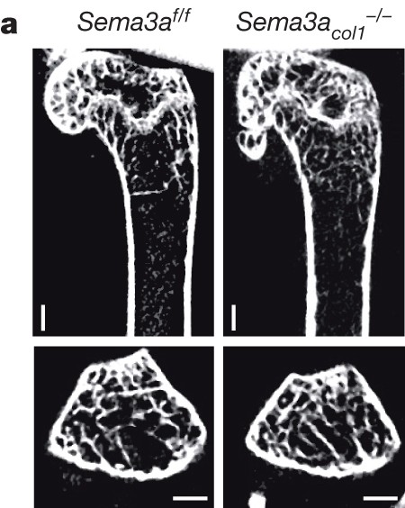 Correction: Corrigendum: Sema3A regulates bone-mass accrual through ...