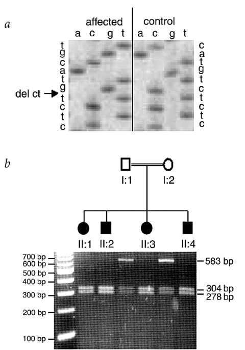 ASPM is a major determinant of cerebral cortical size | Nature Genetics