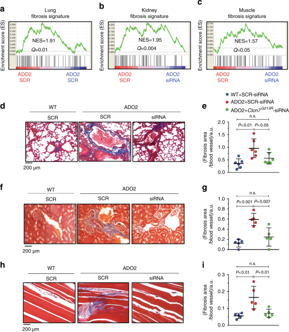 Extra-skeletal manifestations in mice affected by Clcn7 -dependent ...
