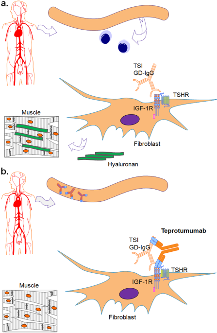 Teprotumumab, an insulin-like growth factor-1 receptor antagonist ...