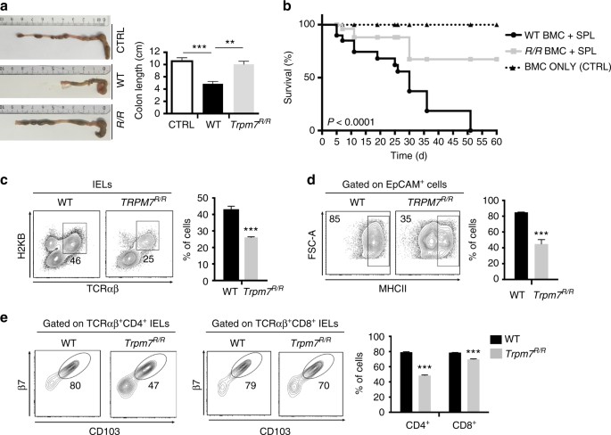 TRPM7 kinase activity is essential for T cell colonization and ...