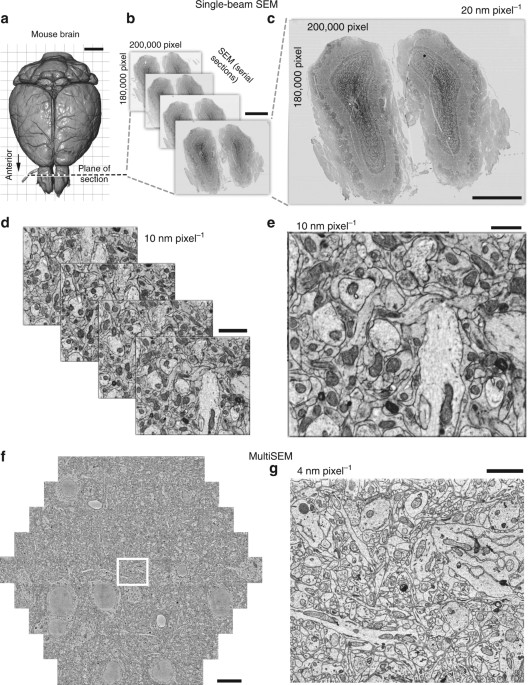 A carbon nanotube tape for serial-section electron microscopy of brain ...