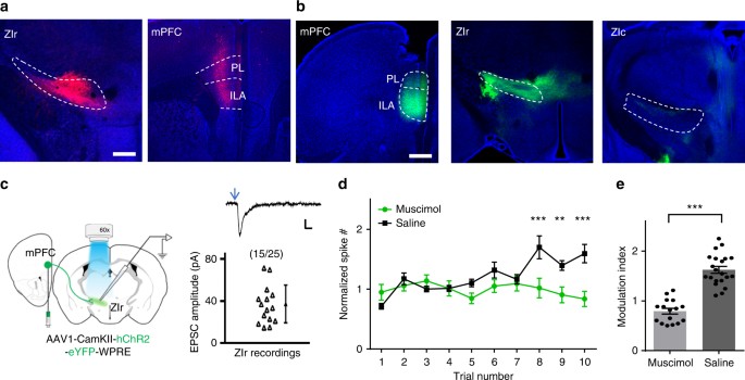 Inhibitory gain modulation of defense behaviors by zona incerta ...