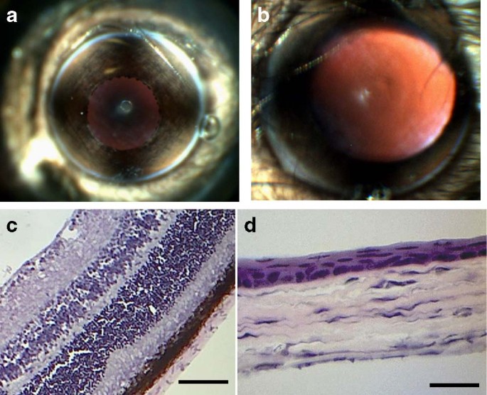 Intravenous treatment of choroidal neovascularization by photo-targeted ...