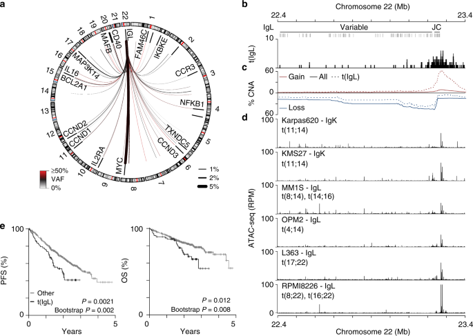 Multiple Myeloma Immunoglobulin Lambda Translocations Portend Poor