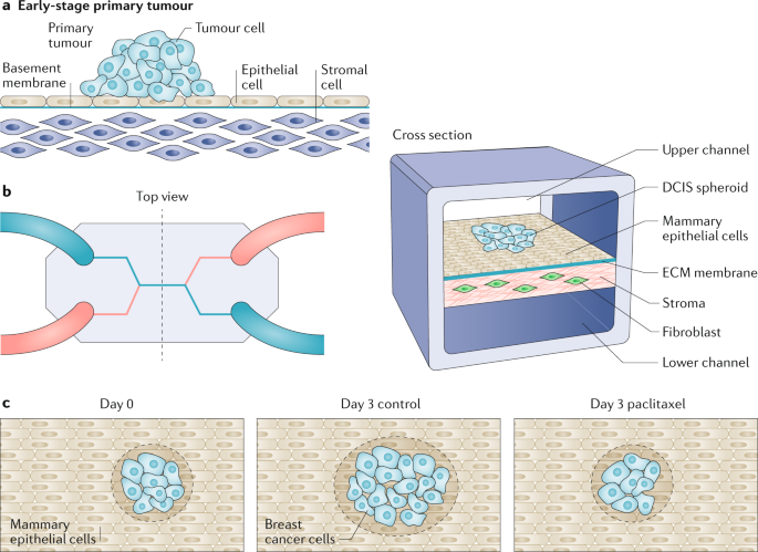 Modelling cancer in microfluidic human organs-on-chips | Nature Reviews ...